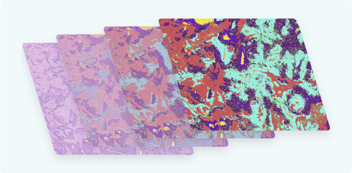 HD Products: Visium HD Spatial Gene Expression - 10x Genomics